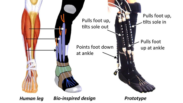 Robotic super socks will aid rehabilitation – EEJournal