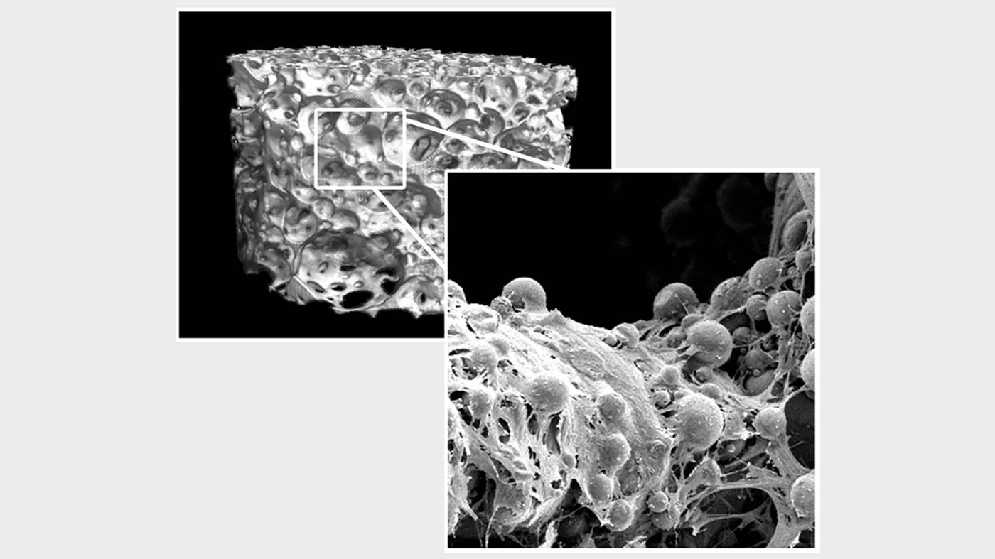 Preconditioned cells may help heal major bone fractures – EEJournal